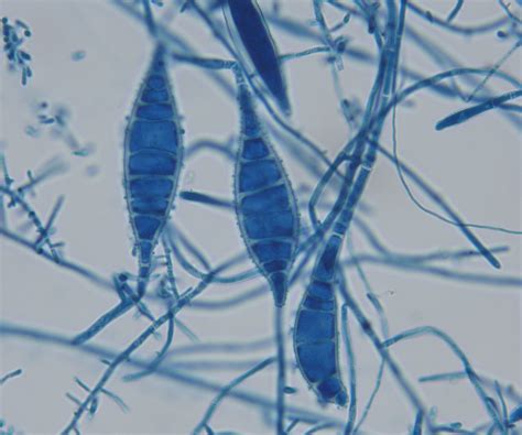 Microsporum Canis Pure Culture Of Microsporum Canis Note Flickr Microsporum Canis Pure Culture Of Microsporum Canis Note Flickr