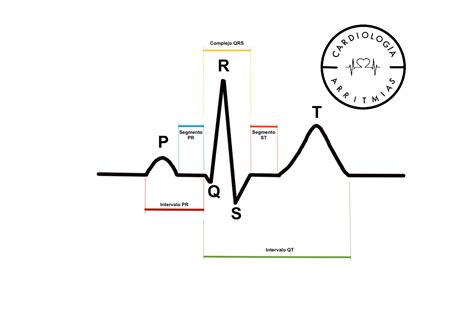 Intervalo Qt Ecg 2025