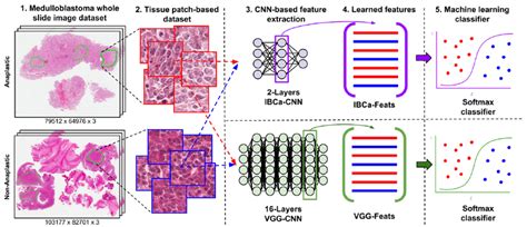 Cnn Based Transfer Learning For Medulloblastoma Tumor Differentiation Download Scientific
