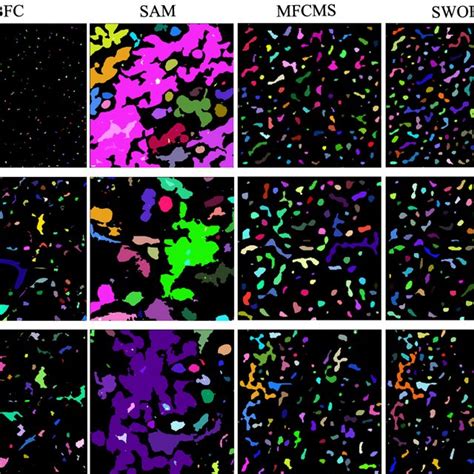 Sample Illustration Of Histopathology Image Segmentation On Three Download Scientific Diagram