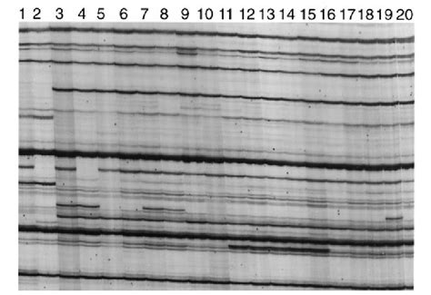 Section Of Autoradiograph Showing Amplified Fragment Length
