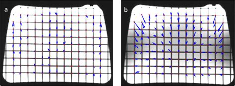 Transverse View Of The T1 Weighted Mr Dataset A With Distortion