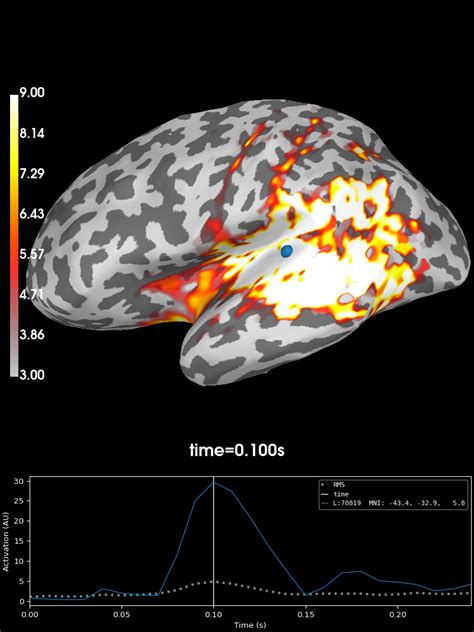 Visualize Source Time Courses Stcs — Mne 1101 Documentation