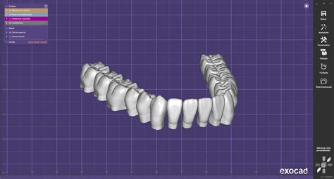 Stl File Teeth Lower Jaw Exocad Alternative 🔧・model To Download And 3d Print・cults