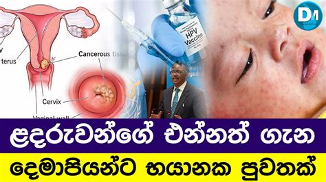 ඔබේ දරුවාට මේ එන්නත් විද්දද දෙමාපියන්ට භයානක පුවතක් Youtube