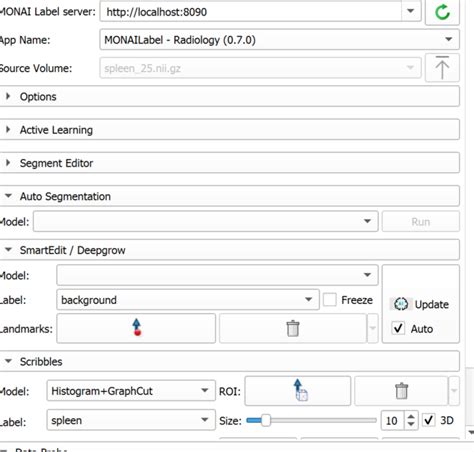 Monai Label In 3d Slicer Auto Segmentation Is Not Working For Loaded Data Support 3d Slicer