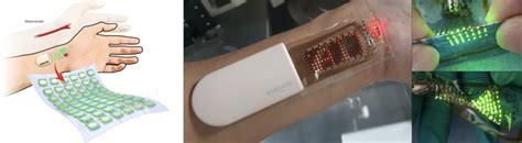 Samsung Comes Up With Stretchy OLED Display That Can Help Monitor Your
