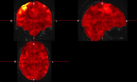 Neuroconductor Example Fmri Task Processing