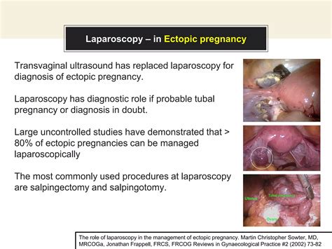 Laparoscopy In Gynecology Pdf