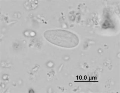 Giardia Cyst Cyst Wet Mount Iodine Stain Department Of