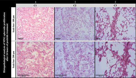 A Shotgun Proteomic Based Approach With A Q Exactive Hybrid Quadrupole Orbitrap High Resolution