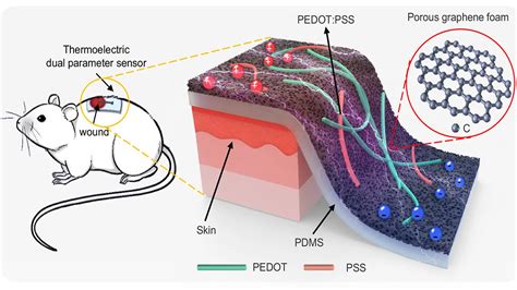 ساخت حسگری برای اندازه‌گیری هم‌زمان دما و فشار مناسب برای پایش زخم