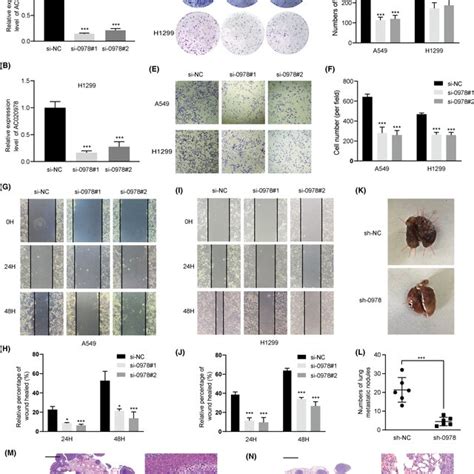 Long Noncoding Rna Lncrna Ac020978 Depletion Inhibits Metastasis Of