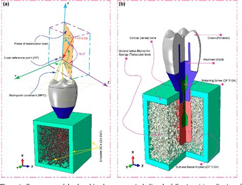 Figure 1 From Advancing 3d Dental Implant Finite Element Analysis