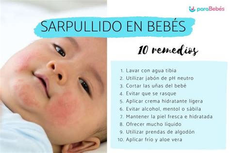 Sarpullido En BebÉs 16 Tipos Causas Y Tratamiento
