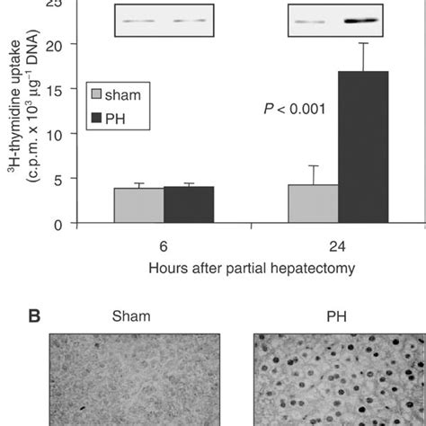 K Protein Expression After Partial Hepatectomy In Mice A Total Rna Download Scientific