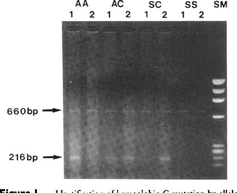 Figure I From Rapid Detection Of The Hemoglobin C Mutation By Allele Specific Polymerase Chain