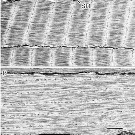 Transmission Electron Micrographs Of Longitudinal Sections Of The