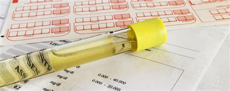 Sel Darah Putih Atau Leukosit Dalam Urine Pertanda Apa