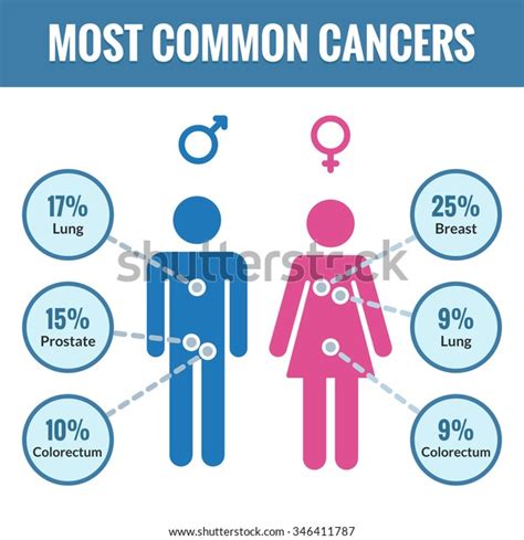 Common Cancer Infographics Top Three Cancer Stock Vector Royalty Free