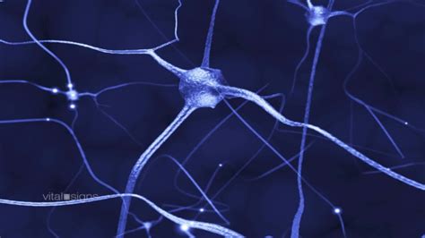 Explain It To Me Concussions Cnn Video