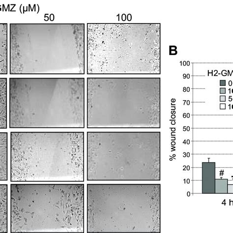 H2 Gamendazole H2 Gmz Treatment Inhibits Cell Migration A Confluent