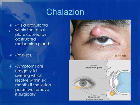 The Orbit Ppt Download