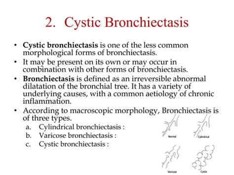 Differential Diagnosis Of Pulmonary Cyst 1 Bullous Emphysema 2