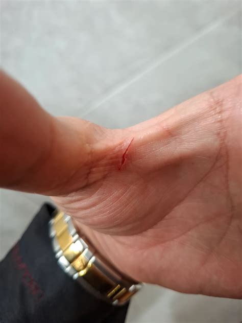 해당 업장에 대해 욕을 하고자 쓰는 글이 아니라 오히려 칭찬하고자 글을 쓴다 팔공산에 위치한 가마솥에누른밥 이다 1 계단 손잡이에 안내문이 깨져서 파편이 뾰족하게