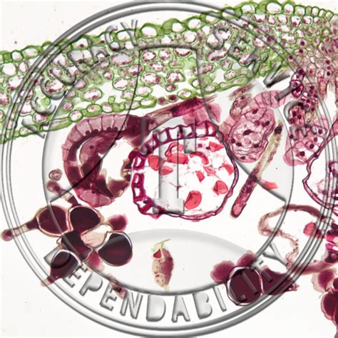 Polypodium Virginianum Leaflet Cs Attached Sporangium Prepared Microscope Slide