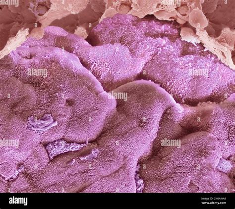 Appendix Coloured Scanning Electron Micrograph Sem Of The Wall Of The Human Appendix Showing
