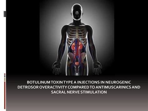 Botulinum Toxin Type A Injections Pptx