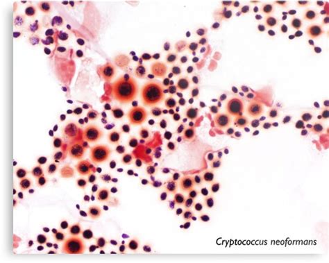 Cryptococcus Neoformans Metal Print By Bpritt Redbubble
