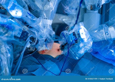 Medical Robotic Surgery Machine Davinci Manual Control By Minimally