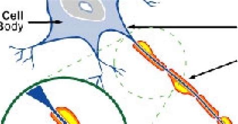 Exacerbations Of Multiple Sclerosis Telegraph Telegraph