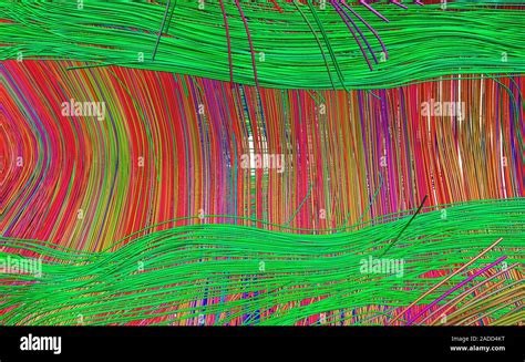 Diffusion Tensor Imaging Dti Scan Reconstructed Brain White Matter