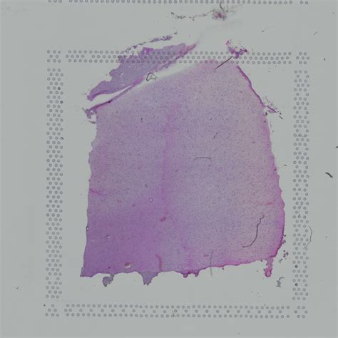 GitHub LieberInstitute SpatialLIBD Code For The SpatialLIBD R