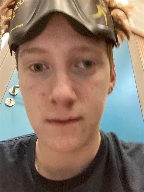 Blind Ron Weasley Here Getting Ready For The Weekly Bdsm Orgy Jk