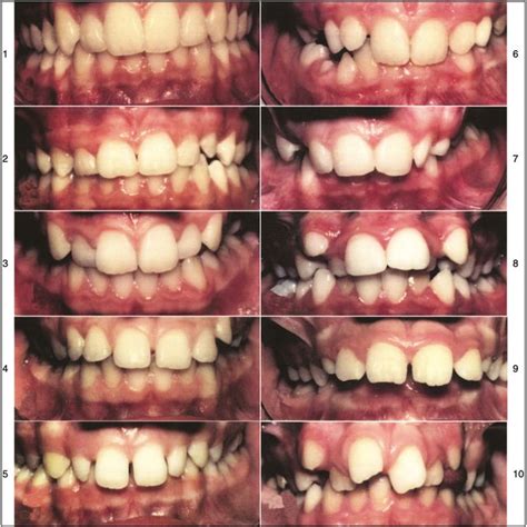 Aesthetic Component Of Iotn Download Scientific Diagram