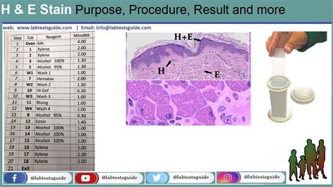 Hematoxylin And Eosin Hande Staining Classification 58 Off