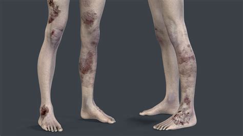 D Zombie Naked Rotten And Bloody Model TurboSquid