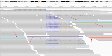 Alignment What Do The Read Colors In Igv Mean Bioinformatics Stack