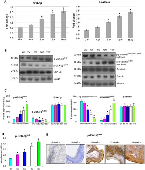 mrna and protein expression of gsk 3β and β catenin during the
