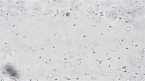 Sperm Swim Against Flow Of Semen Under Microscope Magnification 400 Times On White Background