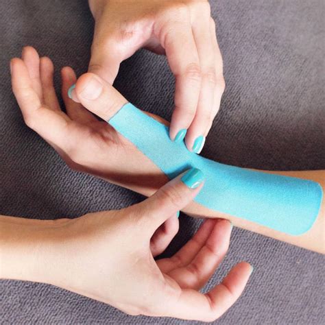 Colles Fracture Treatment