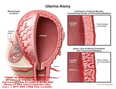 Postpartum Flashcards Quizlet