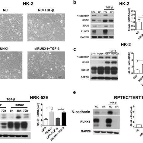 Tubule Specific Deletion Of Runx1 Ameliorates Fa Induced Renal