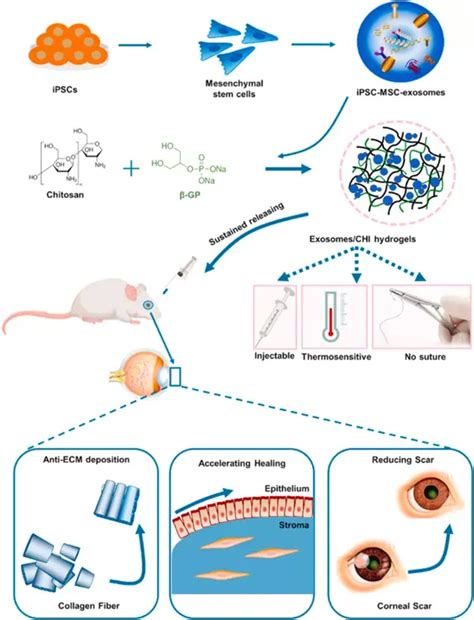 《biomaterials》浙大周民 姚克：外泌体负载热敏水凝胶用于角膜上皮和基质再生 知乎