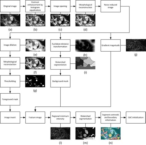 Myocardial Iron Loading Assessment By Automatic Left Ventricle