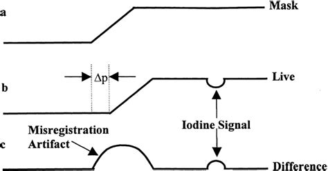 Illustration Of Misregistration Effects In Temporal Subtraction Showing Download Scientific